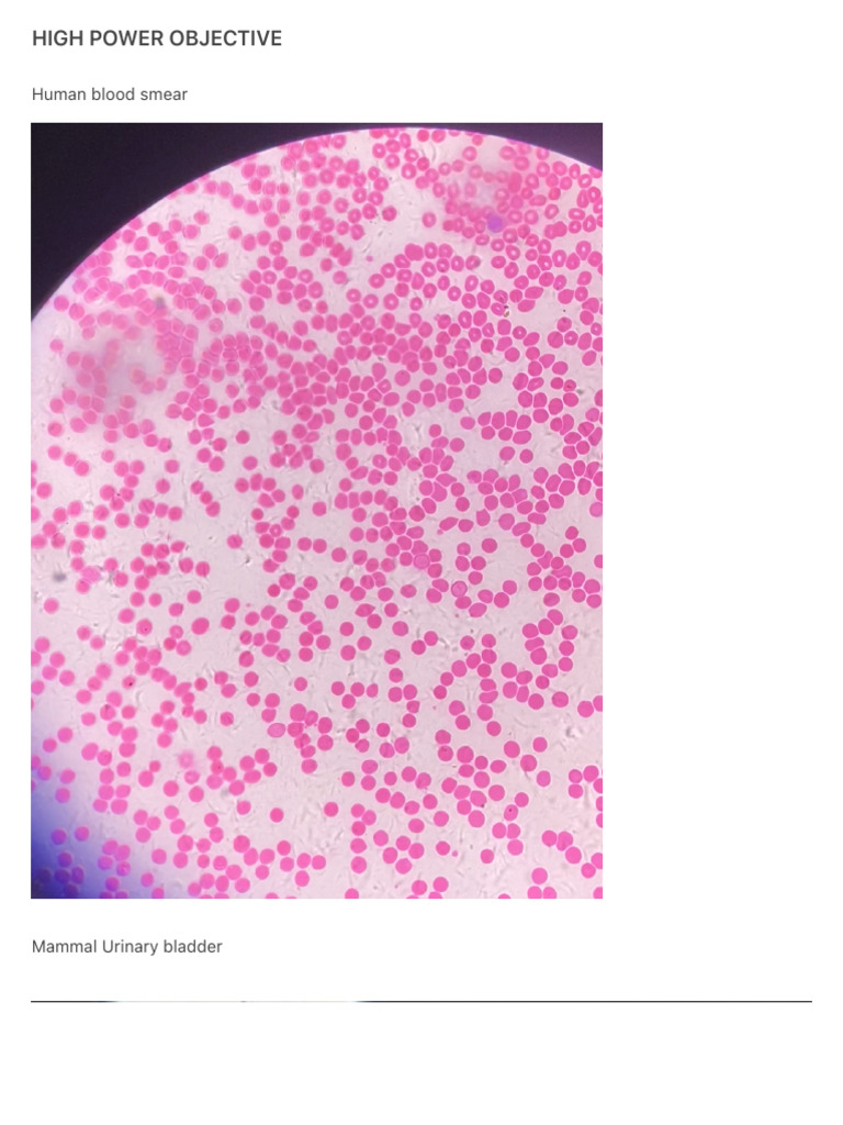 High Power Objective: Human Blood Smear | PDF