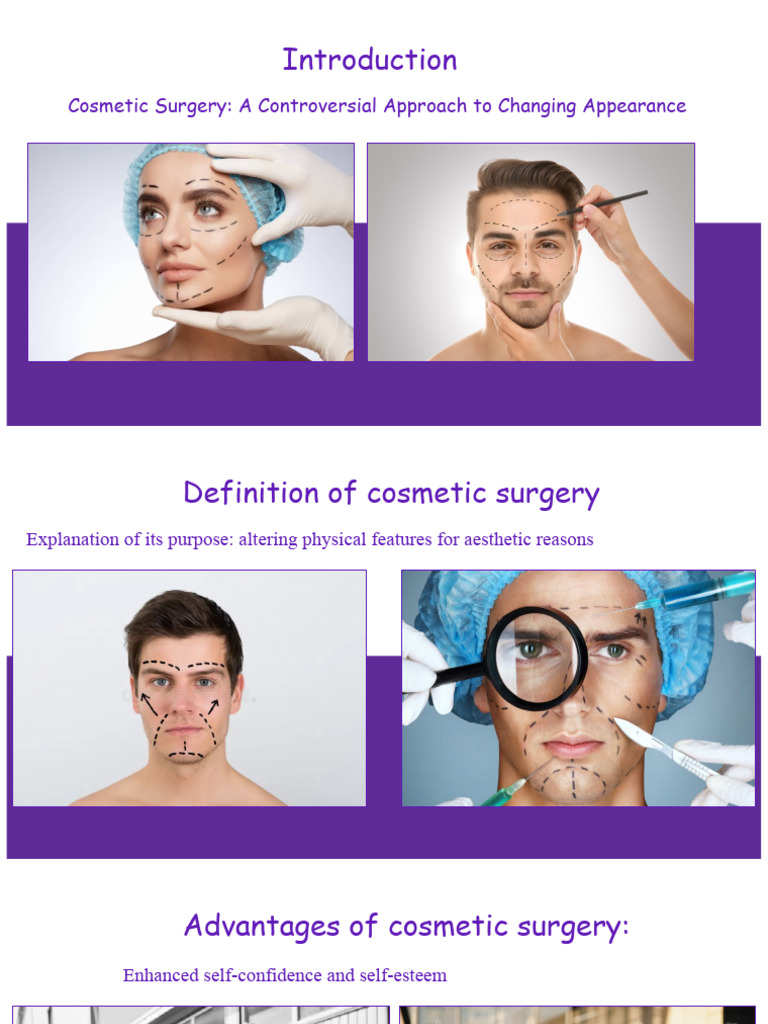 Cosmetic Surgery: Pros, Cons, and Insights | PDF | Business | Self ...