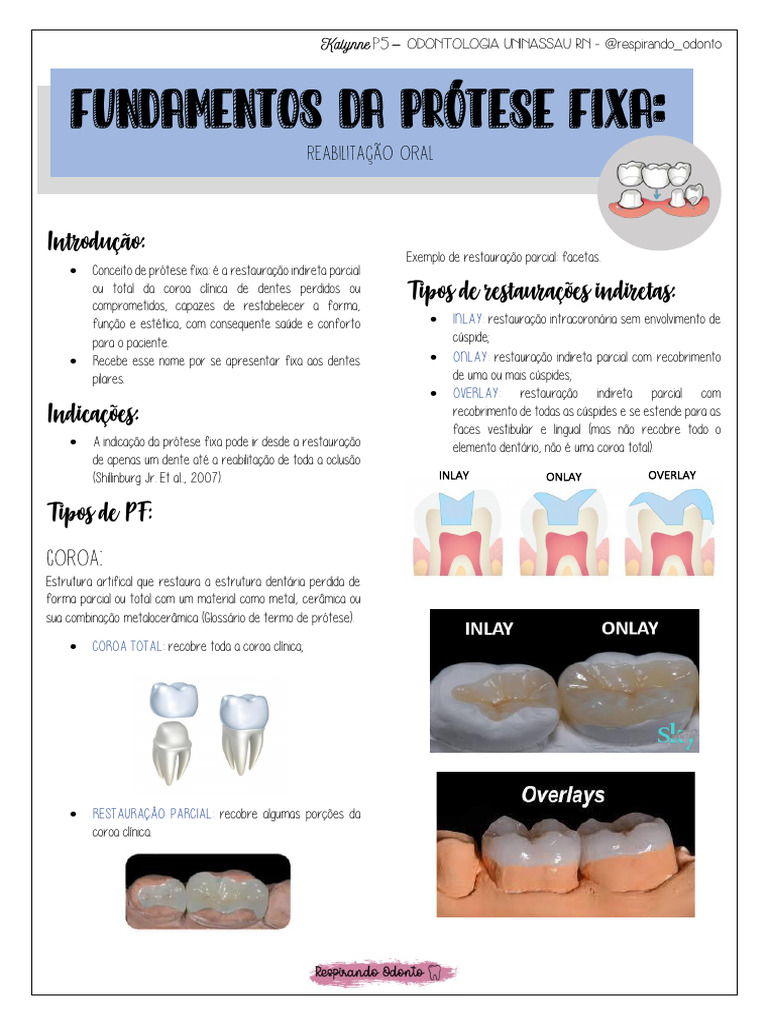 2 - Fundamentos Da Prótese Fixa (Resumo) | PDF | Dente humano | Odontologia