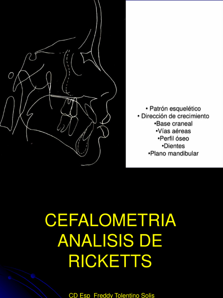 Cefalometria de Ricketts PDF | PDF