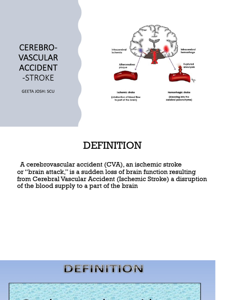 Management of A Cerebro-Vascular Accident (CVA) PT | Download Free PDF ...