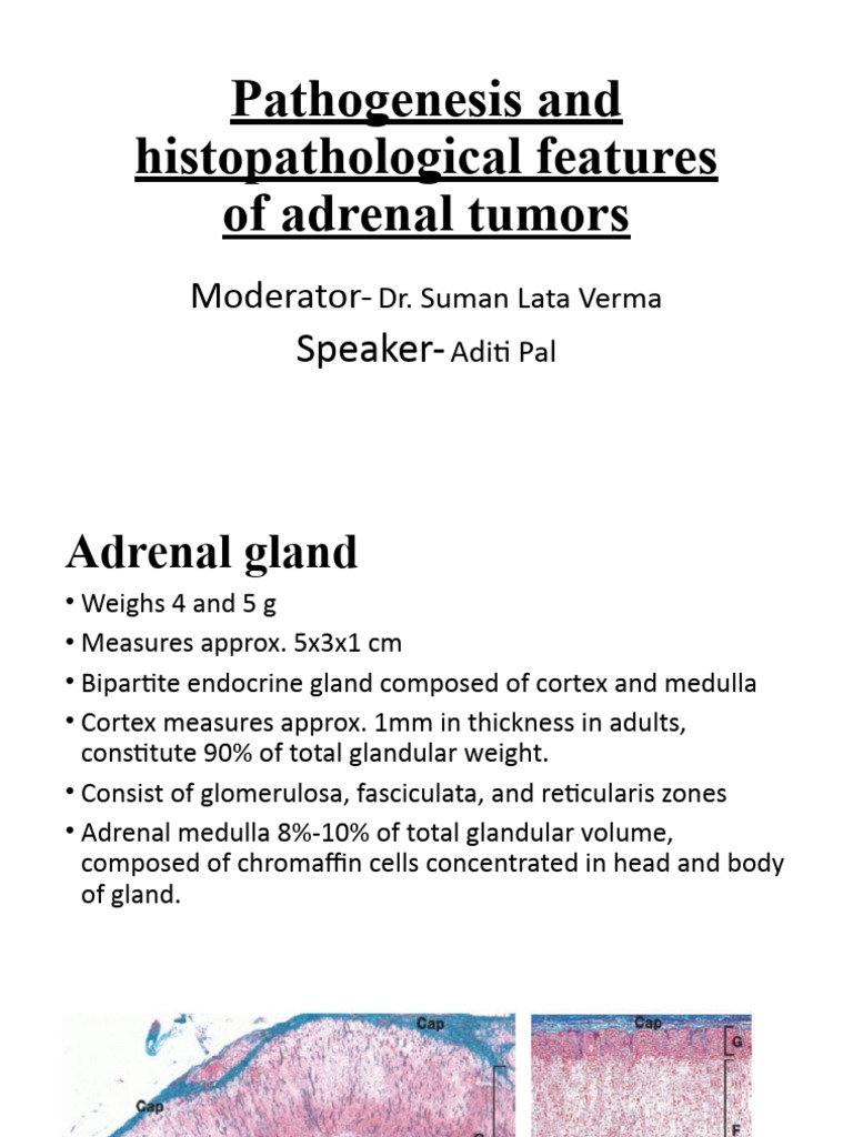 Adrenal Tumor | PDF | Adrenal Gland | Adenoma