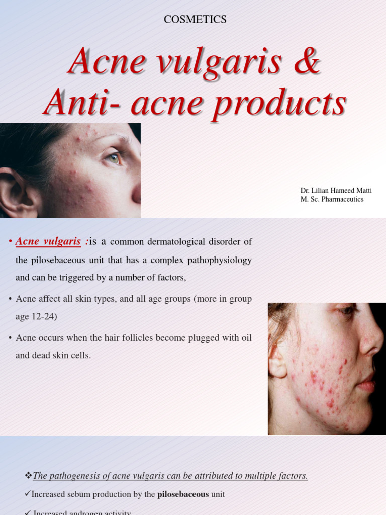 Acne Vulgaris and Anti-Acne Products 2024 | Download Free PDF ...