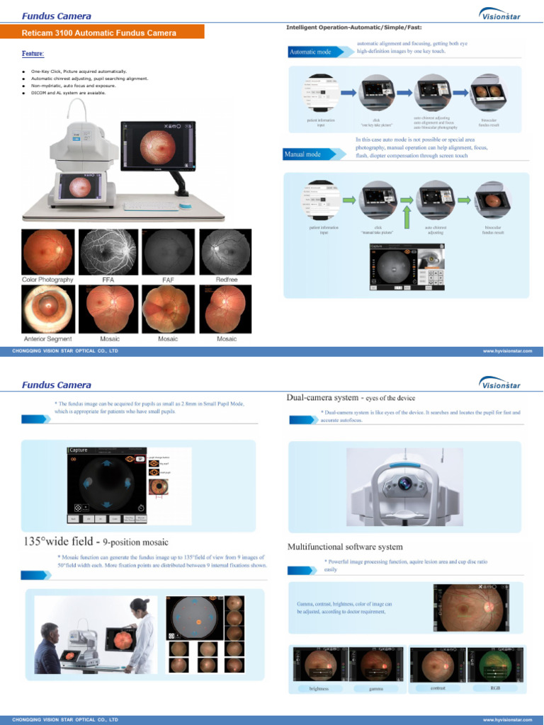 Fundus Camera | PDF | Camera | Autofocus