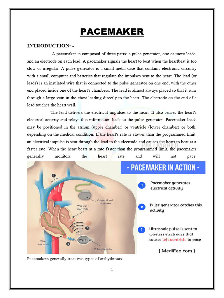 Pacemaker | PDF | Artificial Cardiac Pacemaker | Heart