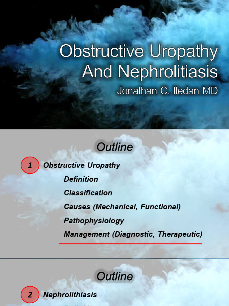 Obstructive Uropathy Nephrolithiasis - Doc. Iledan | PDF | Medical ...