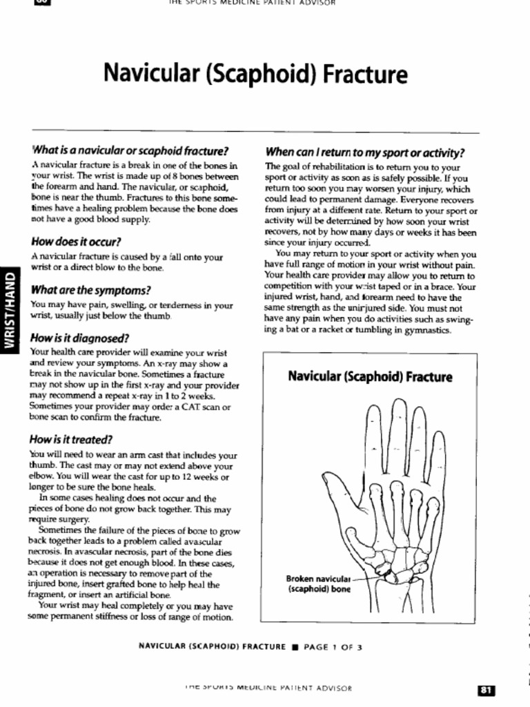 Wrist Scaphoid Fracture | PDF