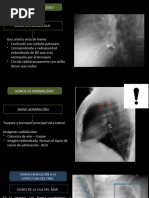 Signos Radiologicos Del Torax | PDF | Tórax | Pulmón