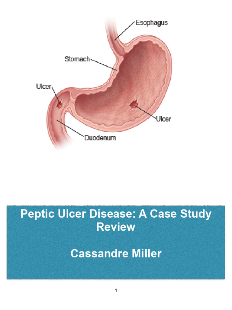 Peptic Ulcer Disease Case Study | PDF | Stomach | Clinical Medicine