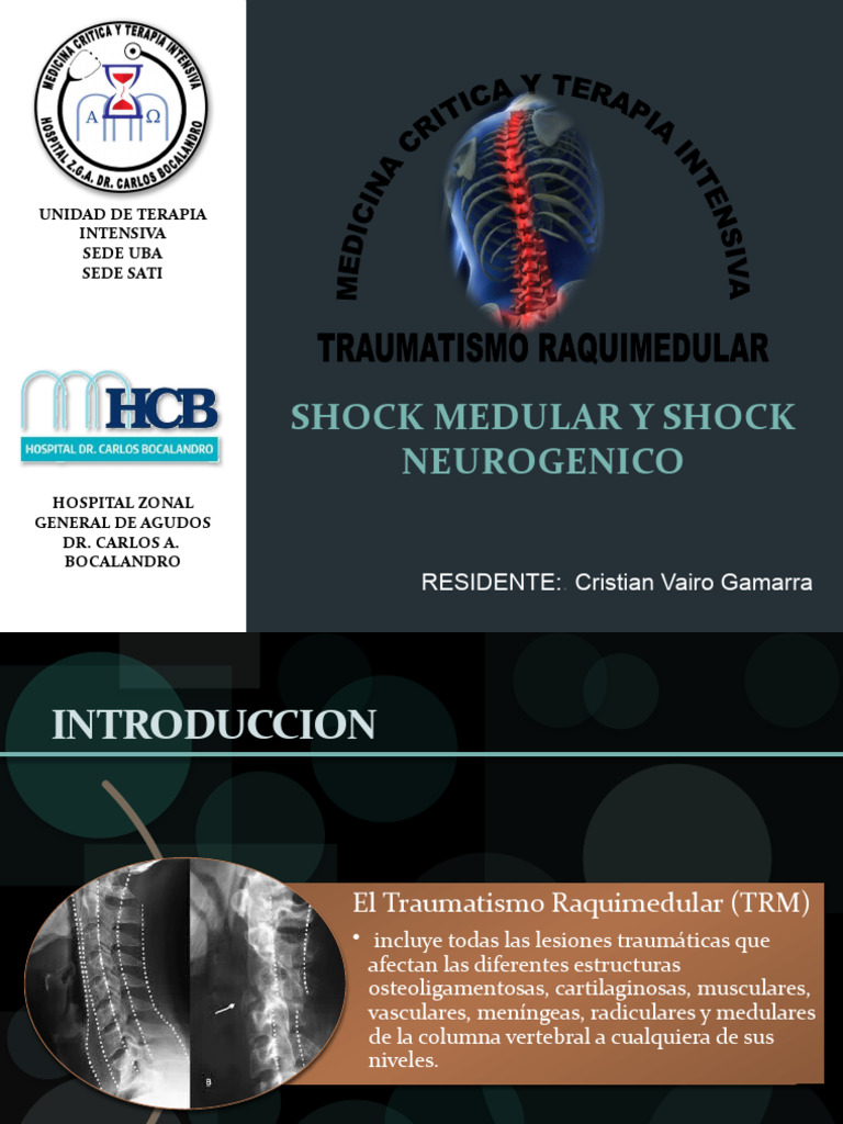 Shock Medular Neurogenico Jose Cristian Vairo | PDF | Choque ...