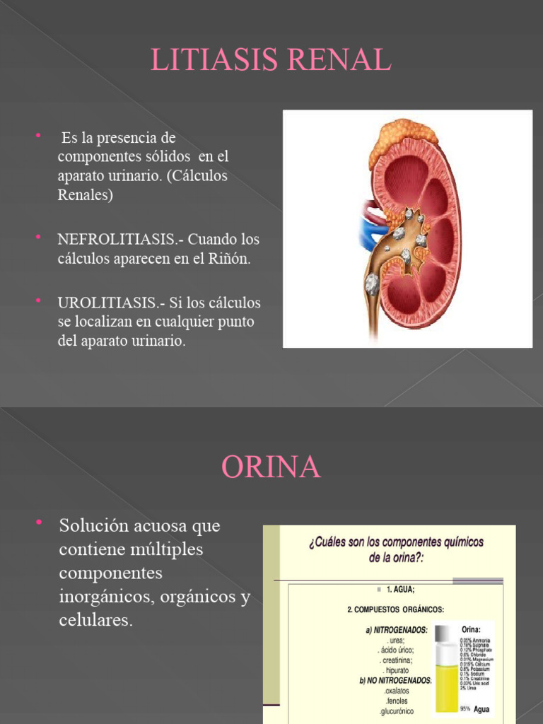 Litiasis Renal | PDF | Calcio