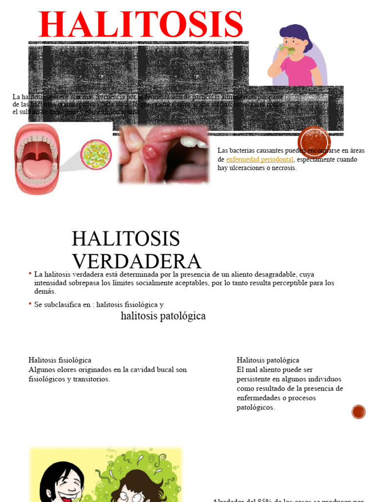 Halitosis | PDF | Medicina CLINICA | Especialidades Medicas