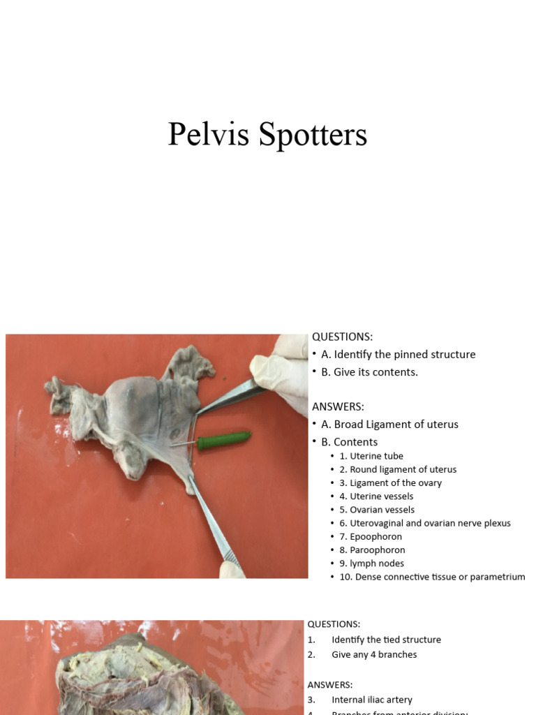 Pelvis Spotters | PDF | Uterus | Prostate