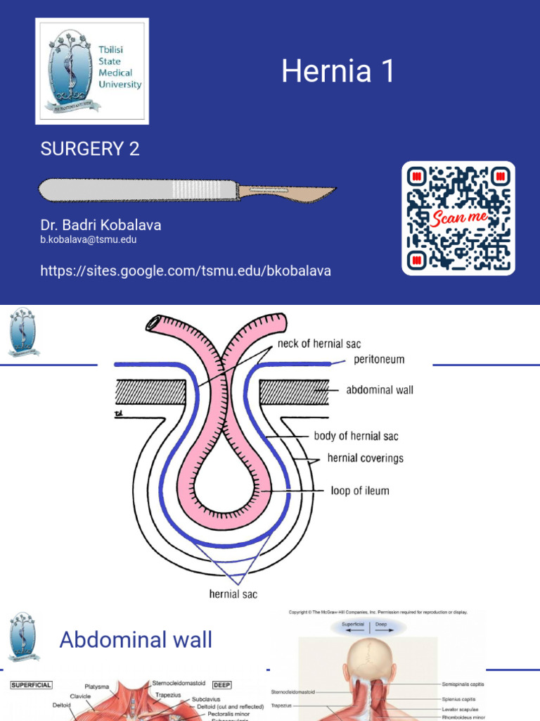 Hernia 1 | PDF | Gastroesophageal Reflux Disease | Clinical Medicine