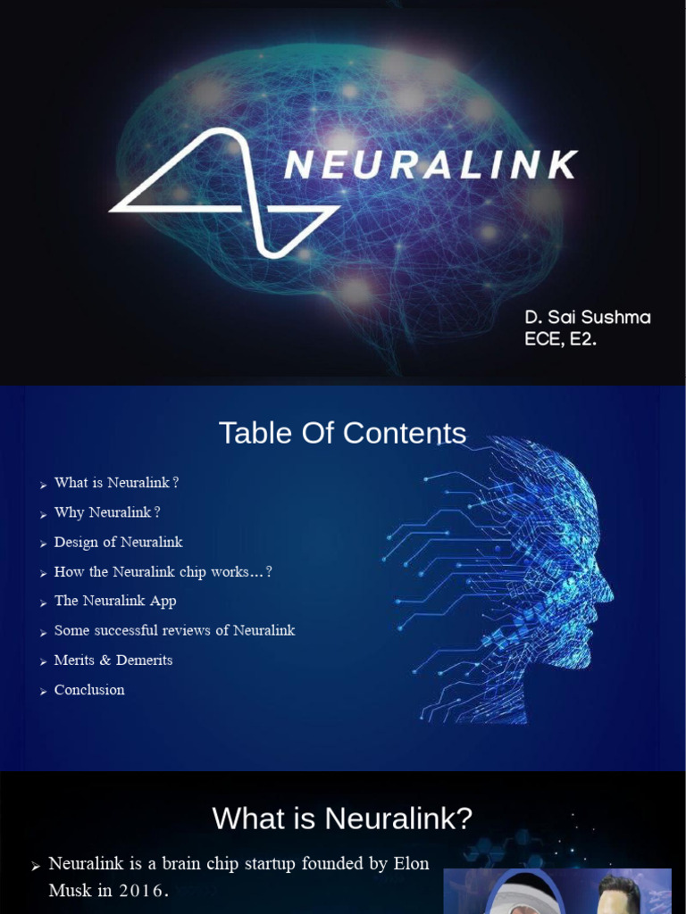 Understanding Neuralink: Brain Chip Insights | PDF | Brain | Neuroscience
