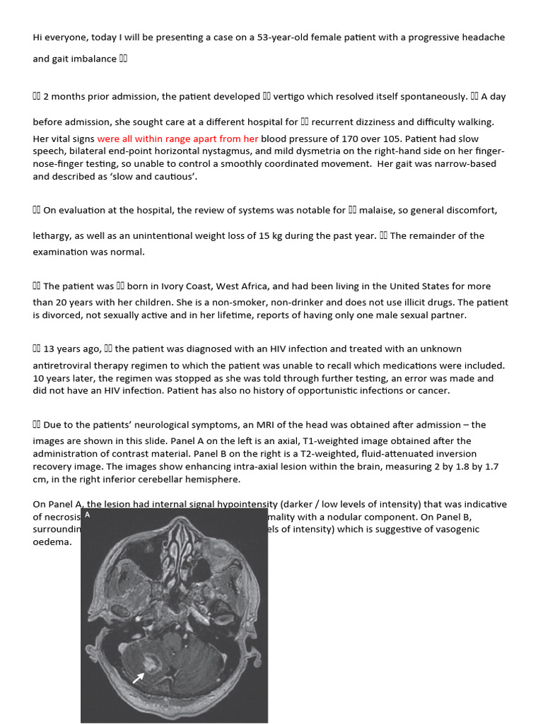 Case Speech | PDF | Hiv | Diagnosis Of Hiv/Aids