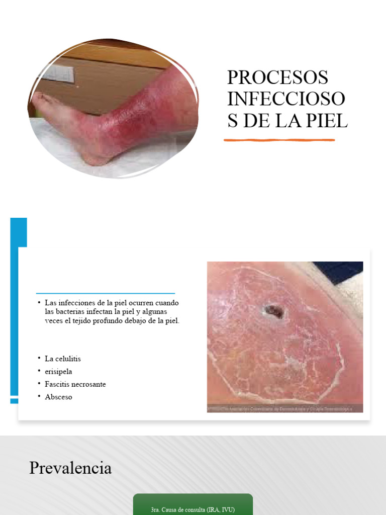Procesos Infecciosos de La Piel | PDF | Causas de la muerte ...