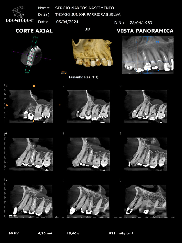 MULTIPLANAR | PDF