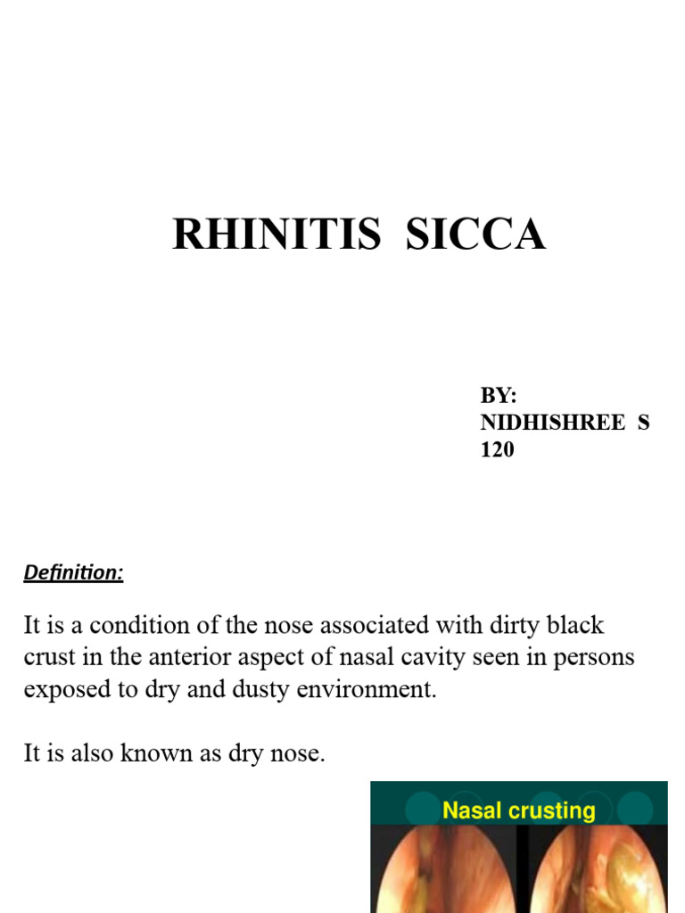 Rhinitis Sicca | PDF