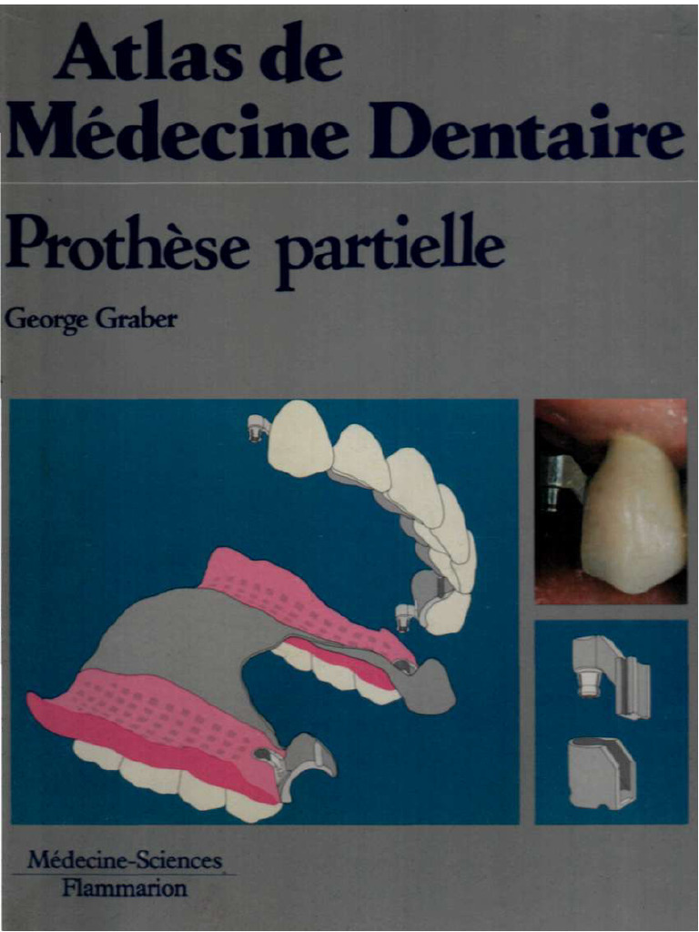 Atlas de Médecine Dentaire Prothèse Partielle - pdf-1 | PDF