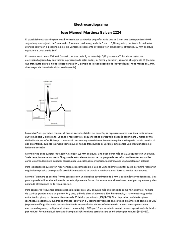 Final Trabajo Electrocardiograma Jose Manuel Martinez Galvan 2224 ... Final Trabajo Electrocardiograma Jose Manuel Martinez Galvan 2224 ...