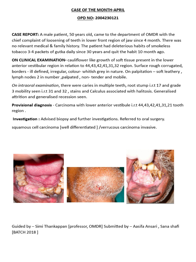 Oral Cancer Case Report: April 2023 | PDF