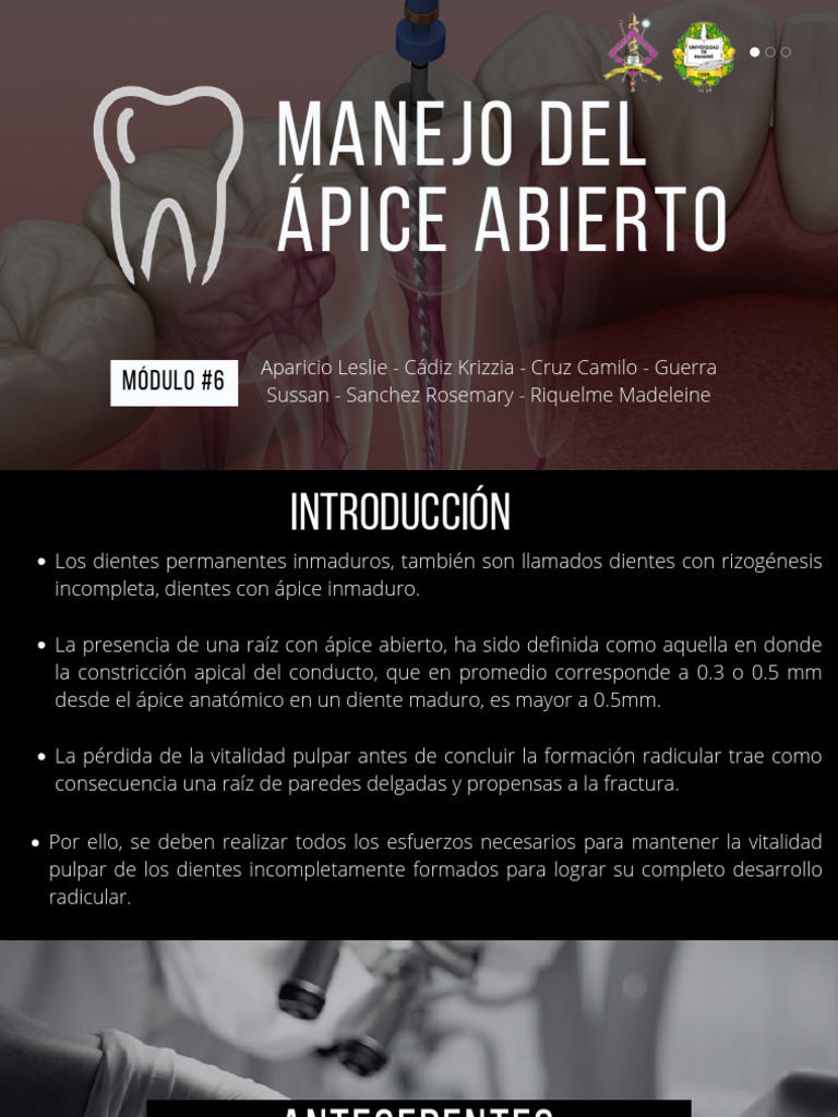Manejo del Ápice Abierto en Endodoncia | PDF | Odontología ...