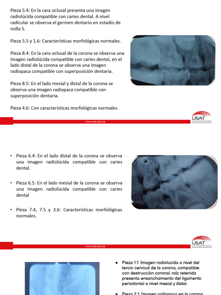 Interpretacion RX | PDF | Síntomas y signos | Dolor