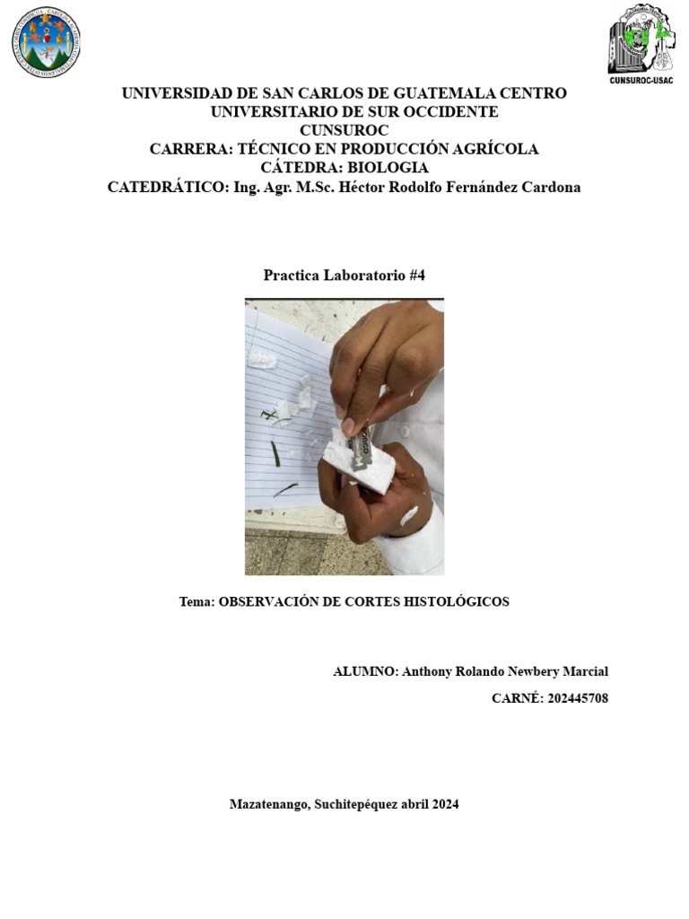 Informe Biologia #4 Anthony | PDF | Histología | Microscopio