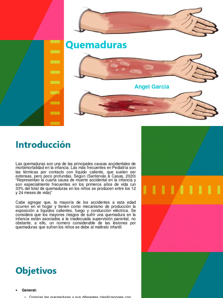 Quemaduras | PDF | Quemar | Herida