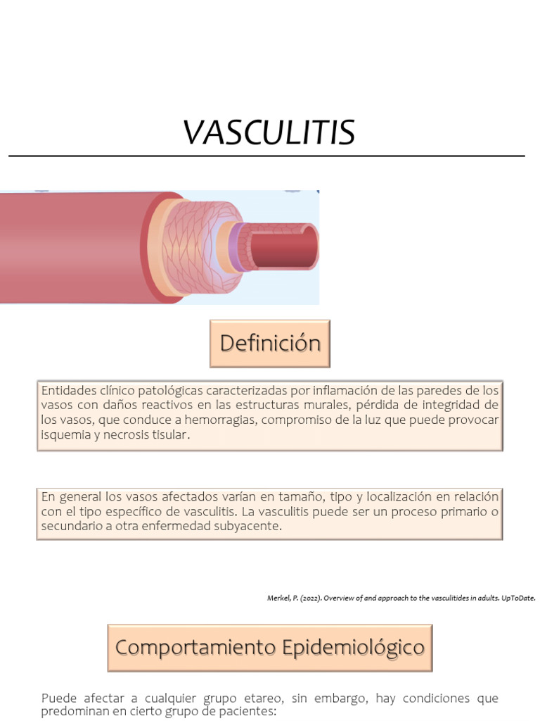 VASCULITIS (1) (Solo Lectura) | PDF | Especialidades Medicas | Enfermedades y trastornos
