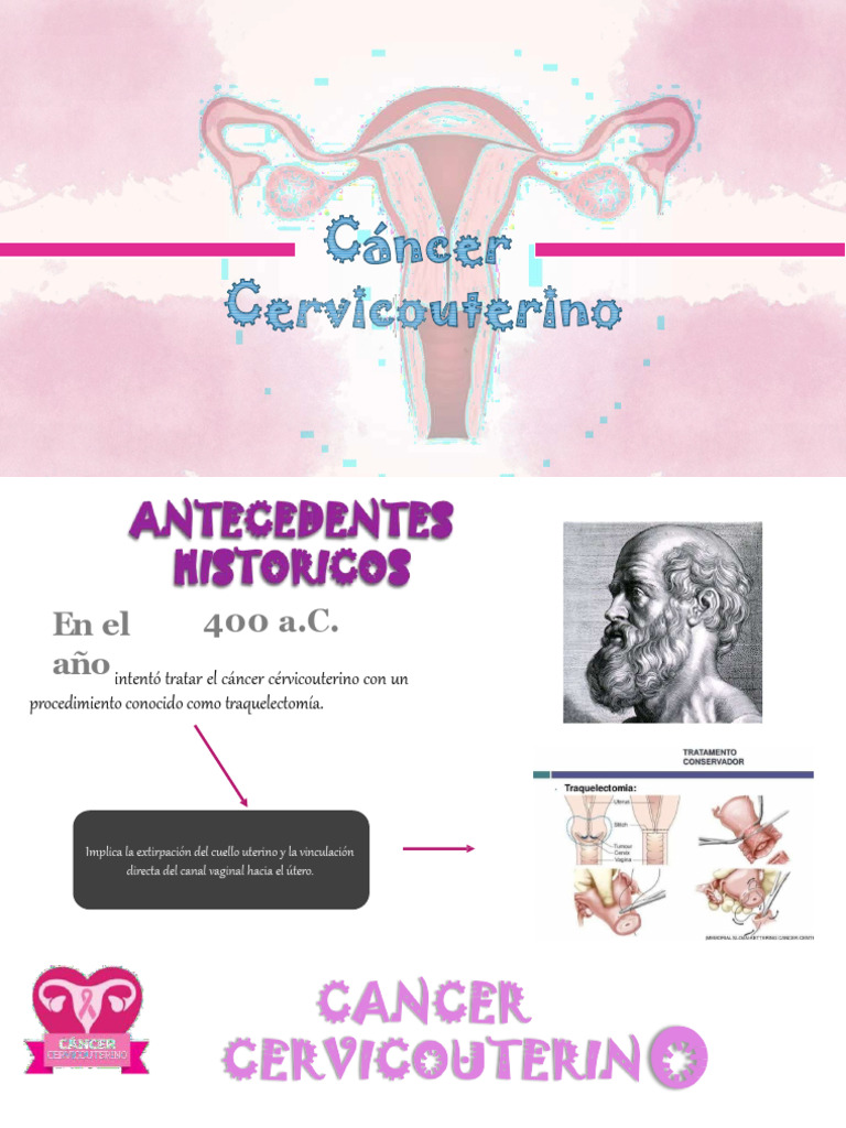 Cáncer Cervicouterino: Diagnóstico y Tratamiento | PDF | Cáncer de ...