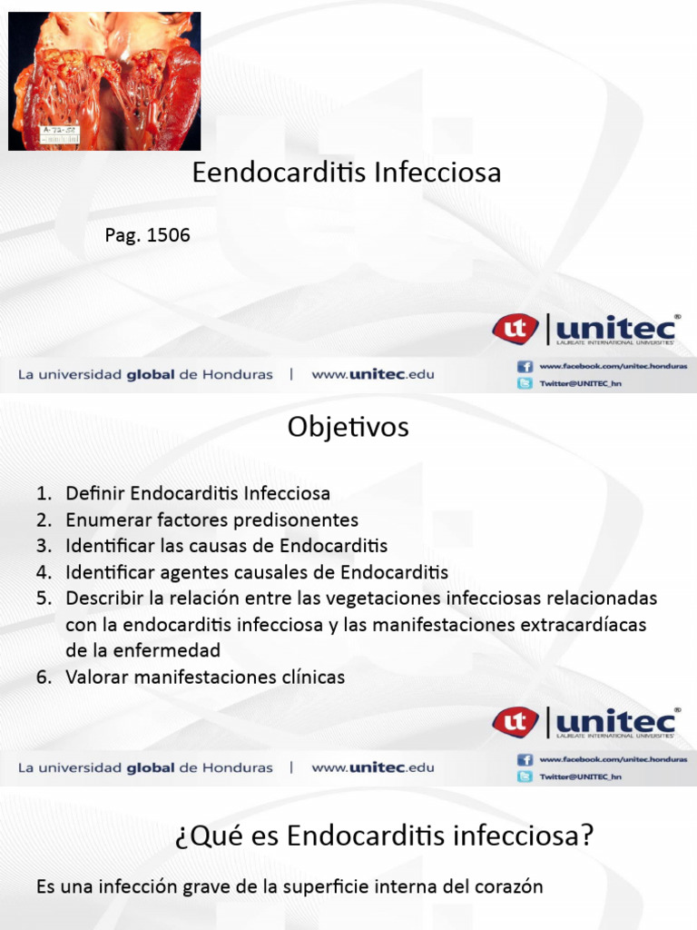 Endocarditis Infecciosa: Causas y Síntomas | PDF | Medicina | Microbiología