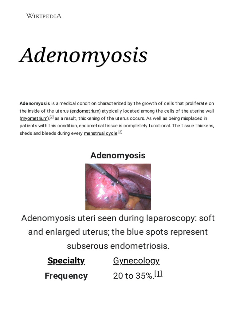 Understanding Adenomyosis Symptoms | PDF | Gynaecology | Mammal Female ...
