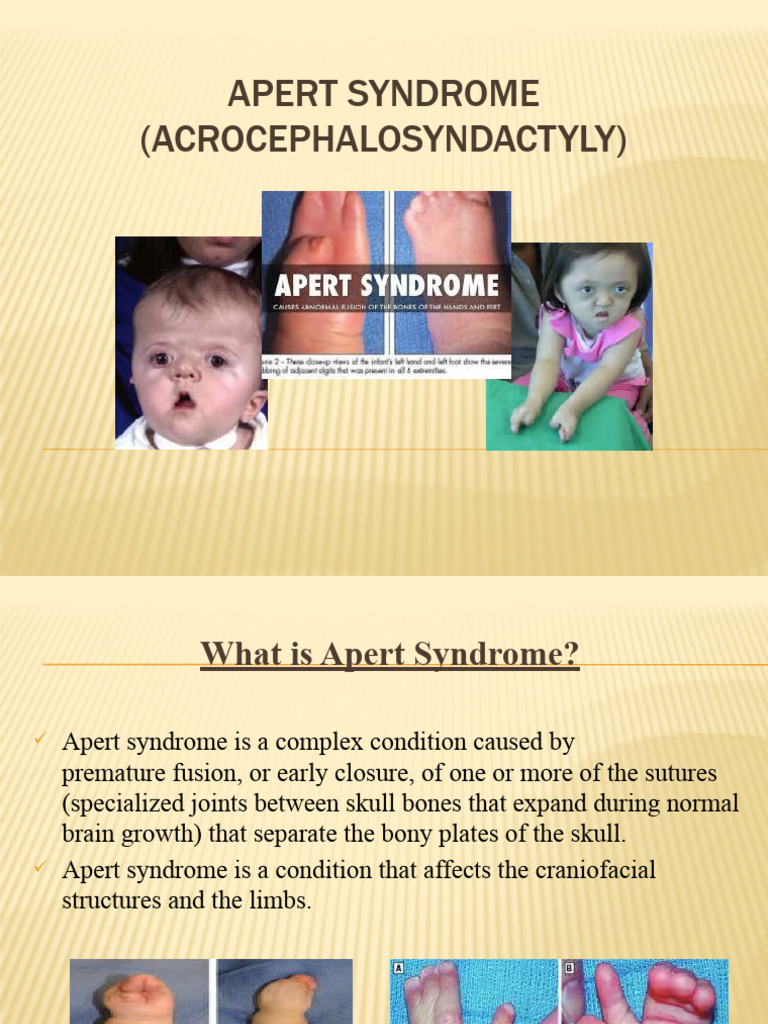 Apert Syndrome | PDF | Congenital Disorder | Diseases And Disorders