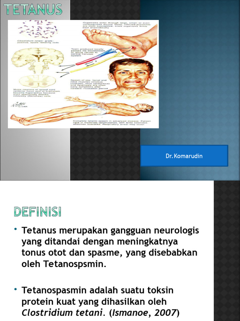 Tetanus | PDF | Kesehatan Holistik | Sains & Matematika