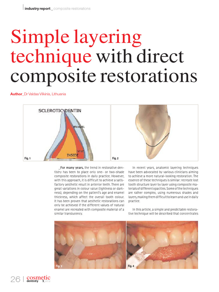 Simple Layering | PDF | Tooth Enamel | Tooth