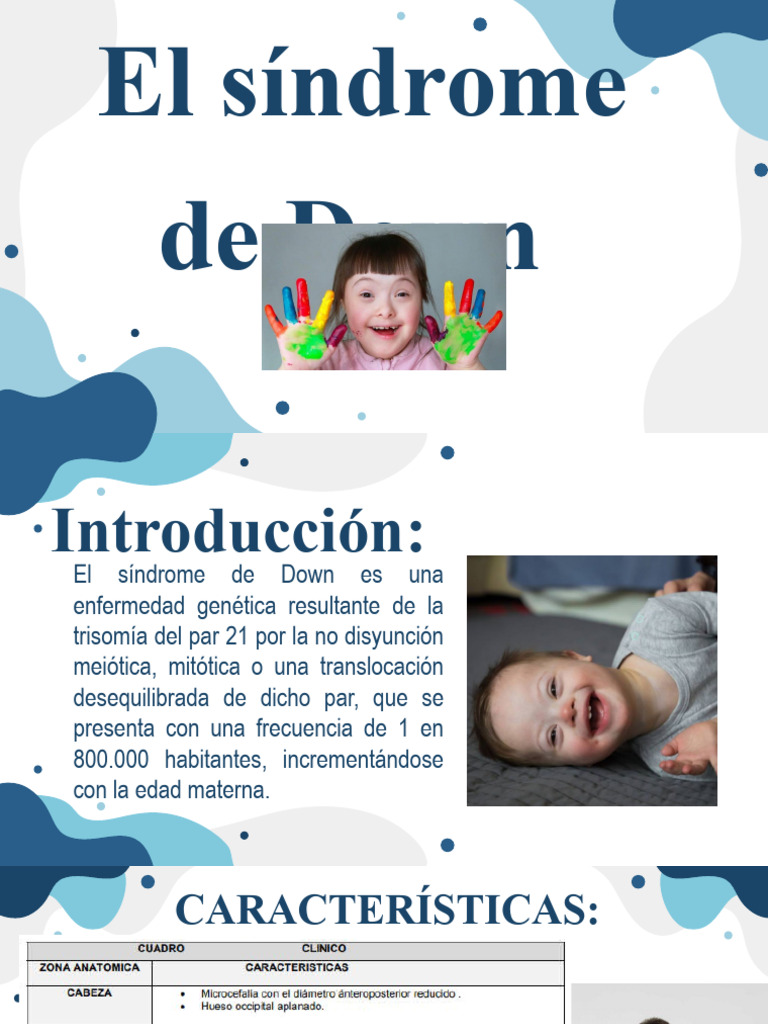 Características del Síndrome de Down | PDF | Aprendizaje | Síndrome de Down