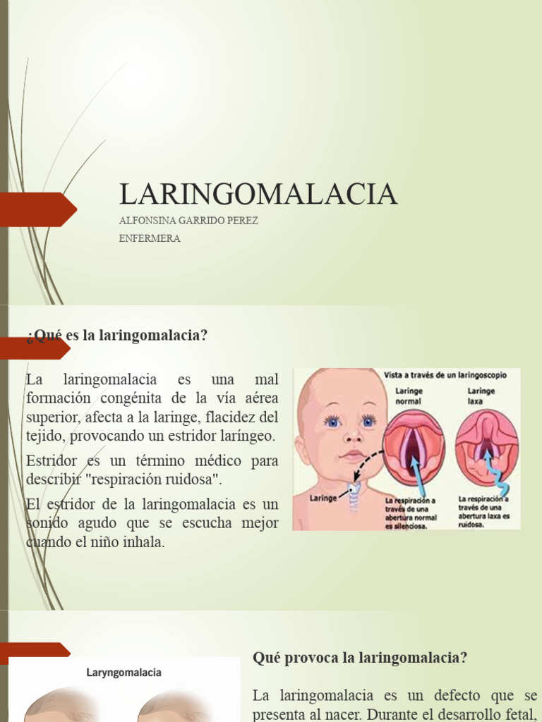 Laringomalacia | PDF | Salud y bienestar