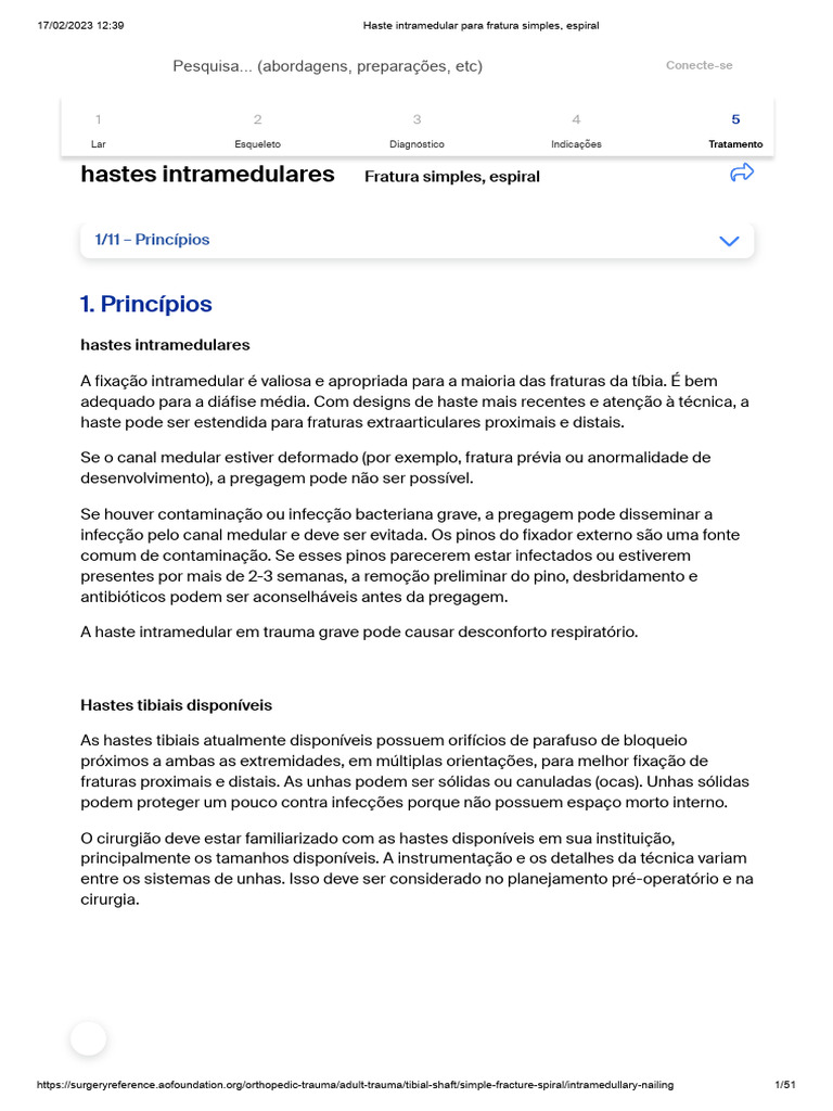 Haste Intramedular para Fratura Tibial | PDF | Parafuso | Joelho