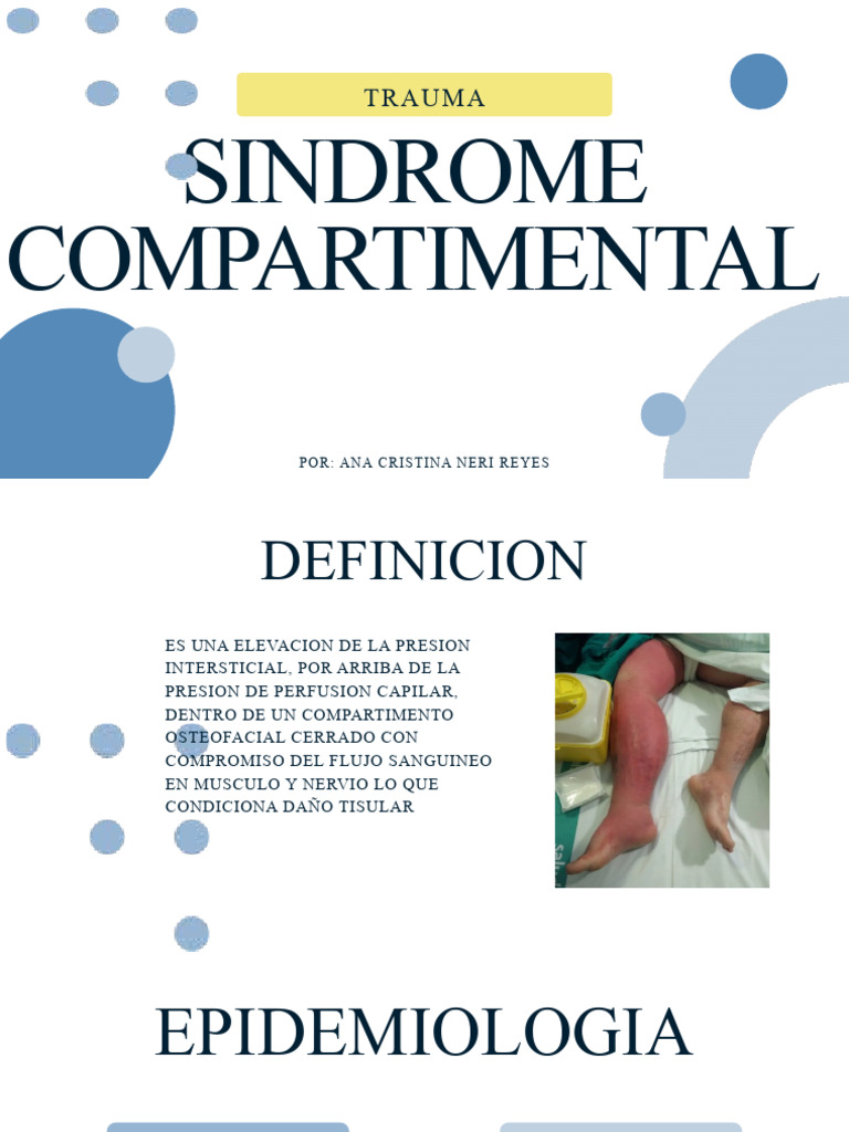 Síndrome Compartimental | PDF | Isquemia | Edema