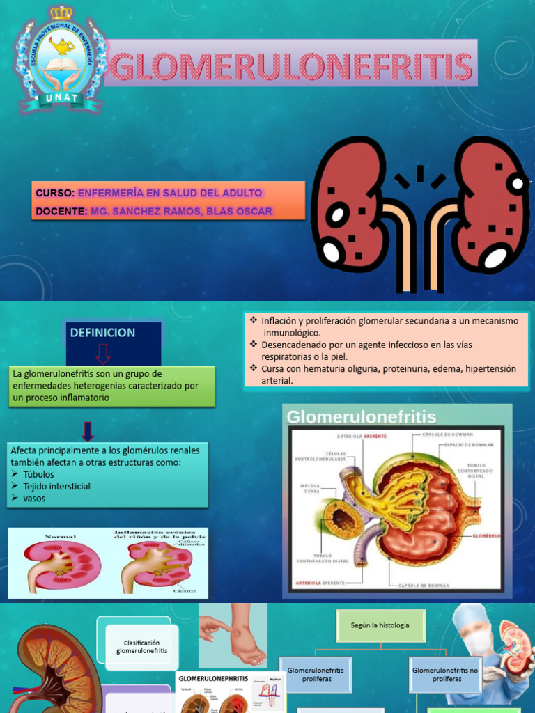 Glomerulonefritis - Youl QV | PDF | Nefrología | Riñón