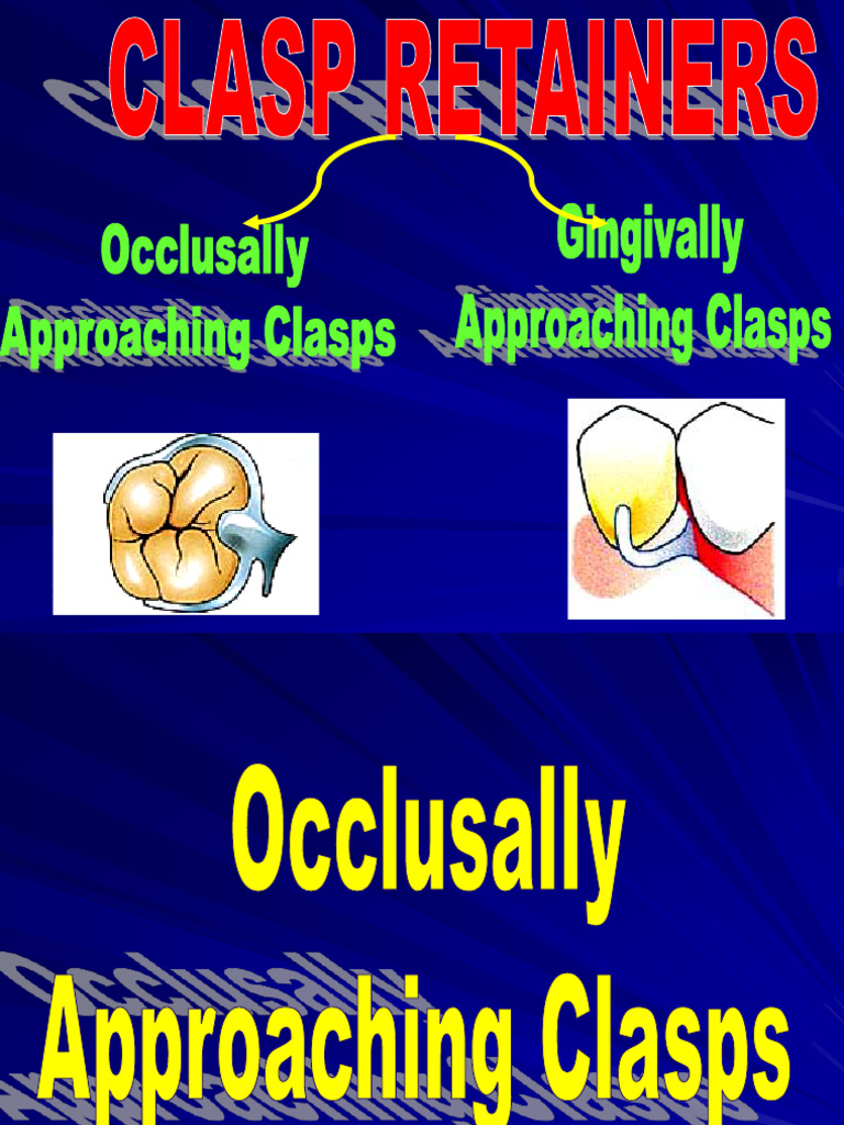Dental Clasp Design Guide | PDF | Mouth | Tooth