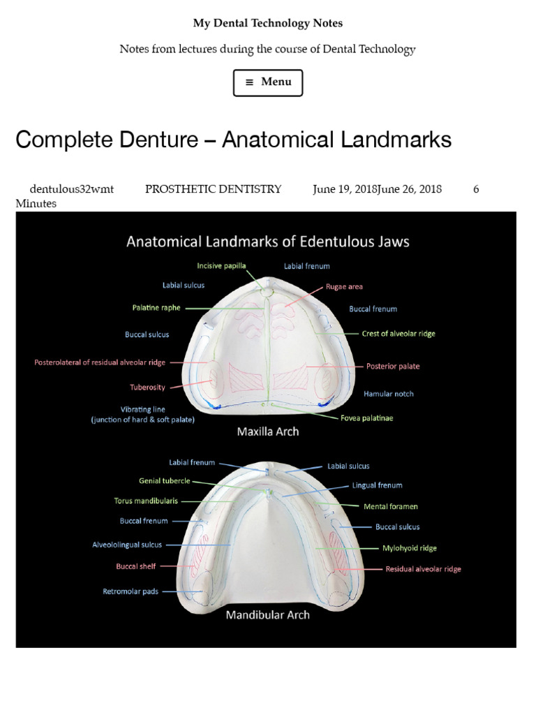 Complete Denture Anatomical Landmarks | PDF | Dentures | Lip
