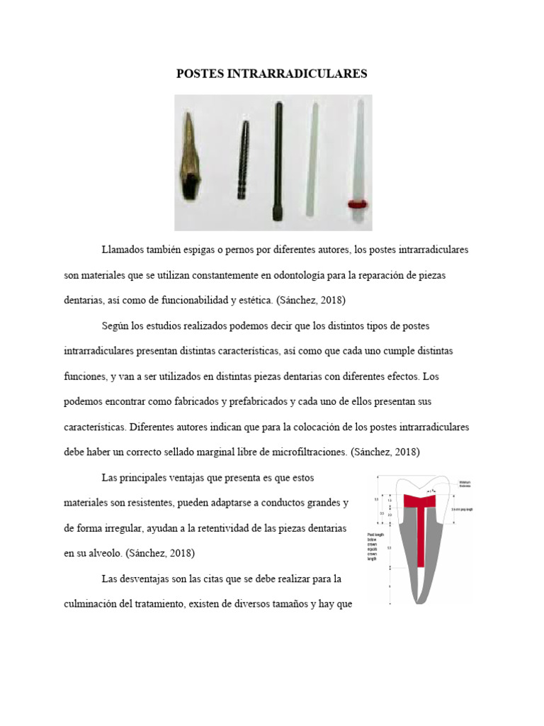 Postes Intrarradiculares Concepto Zarama | PDF | Diente