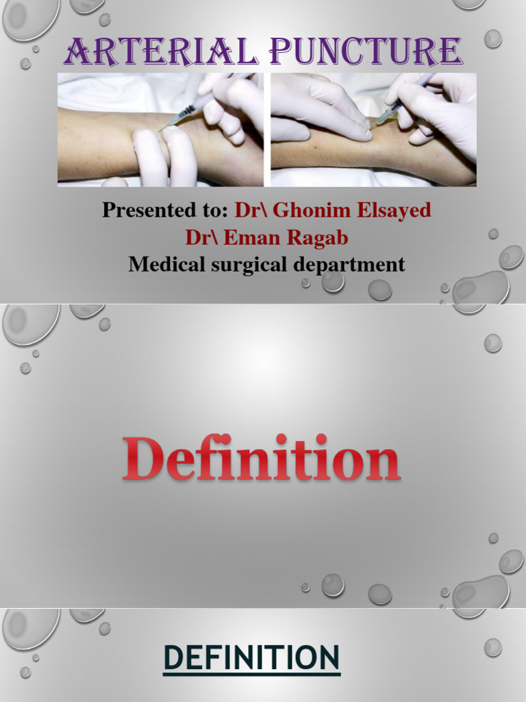 Arterial Puncture | PDF | Hand | Medicine