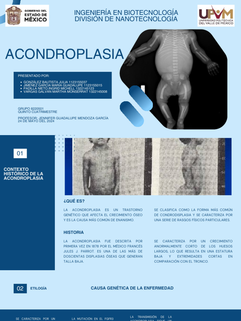 BM Gonzalezbautista Acondroplasia Presentacionpdf | PDF | Terapia ...