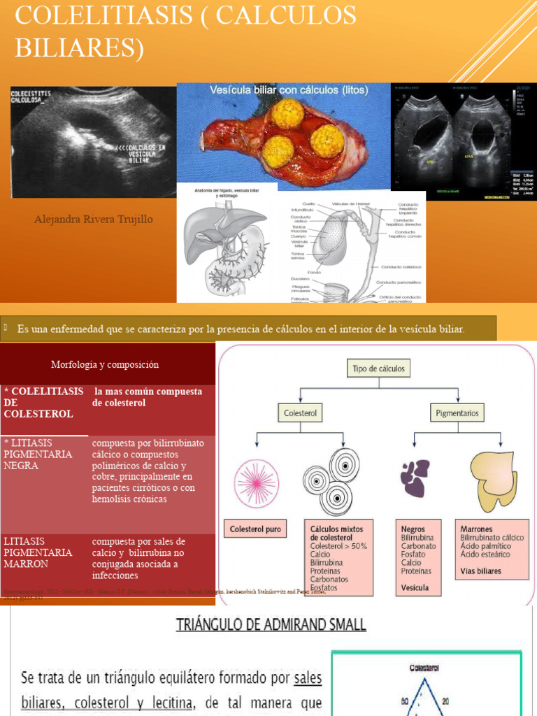 COLELITIASIS | PDF | Gastroenterología | Enfermedades y trastornos