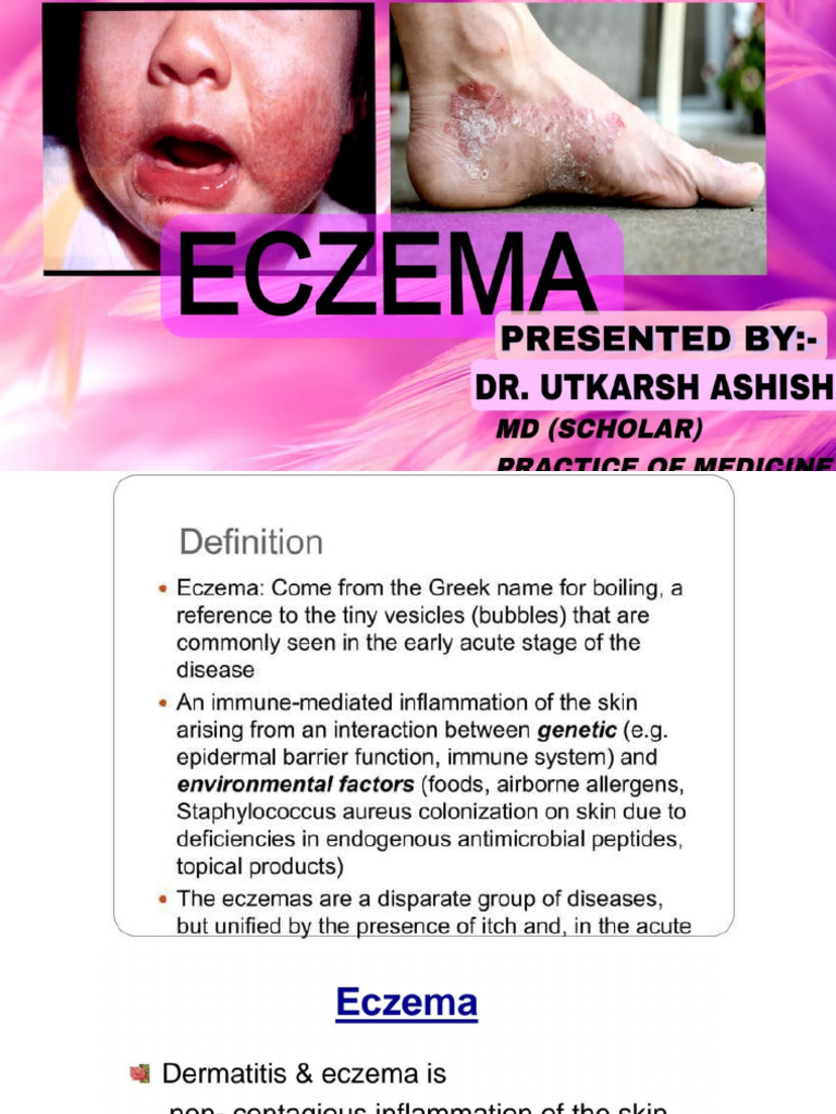 Eczema Dr Utkarsh Final Pdf