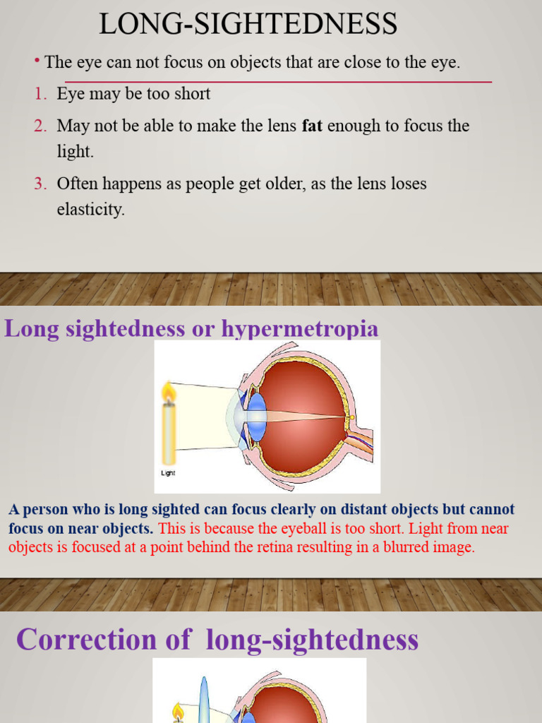 Eye Defect To Write... | PDF